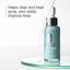 Acne Solutions Acne + Line Correcting Serum - Clinique | Ulta Beauty