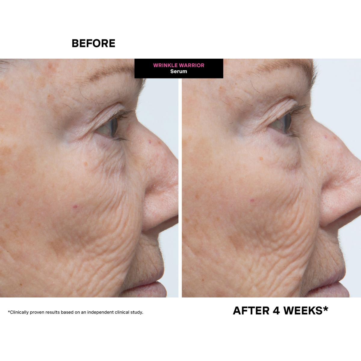 Kate somerville wrinkle warrior hydration gel store