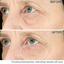 Hyperlift Eye Instant Eye Fix For Bags, Lines & Crepiness - StriVectin ...