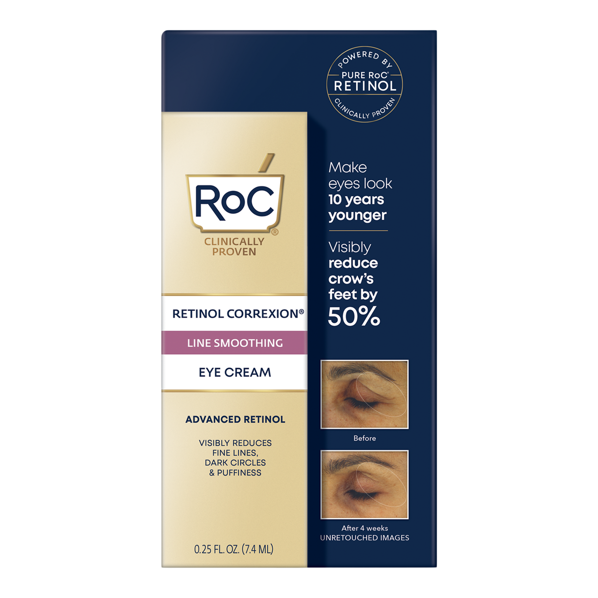 RoC 0.2 oz Retinol Line Smoothing Anti Wrinkle for Dark Circles Eye Cream Ulta Beauty