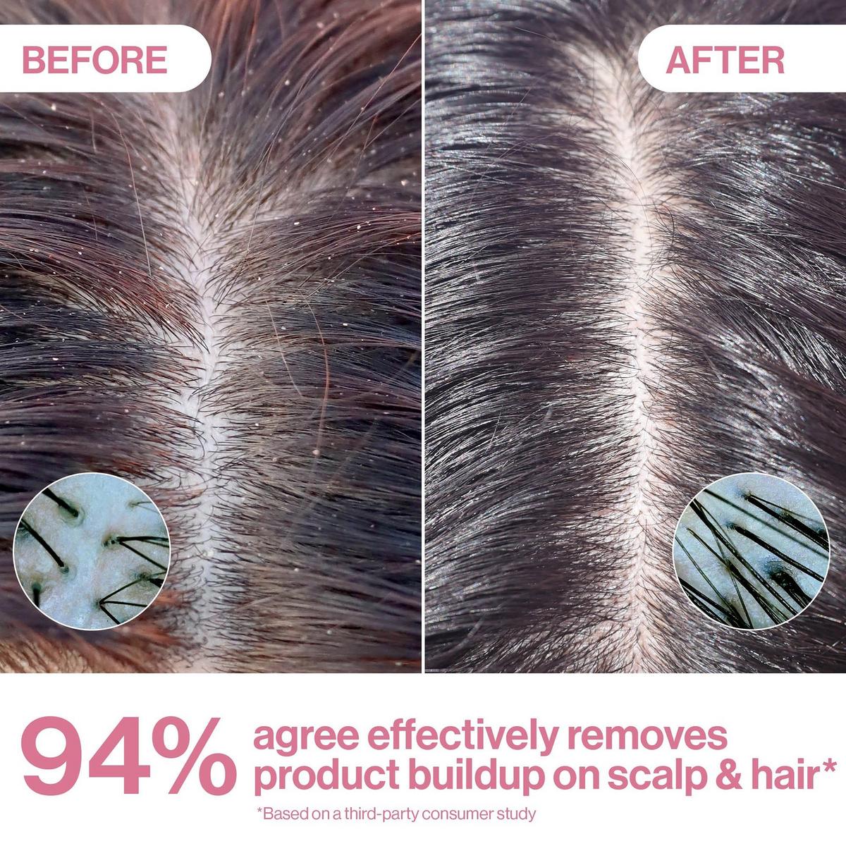 Rinsing hair with apple cider vinegar store