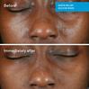 Rapid Relief Acne Sulfur Clay Mask - Murad | Ulta Beauty
