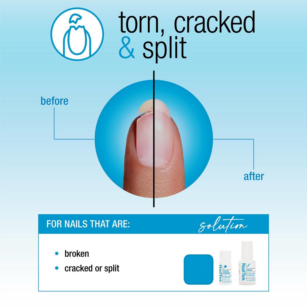 Split nail treatment store