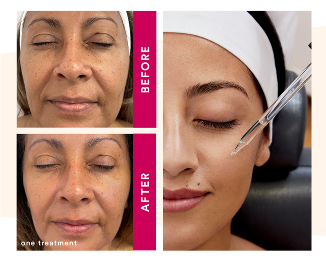 The Skin Bar | Facials & Skin Services | The Salon at Ulta Beauty